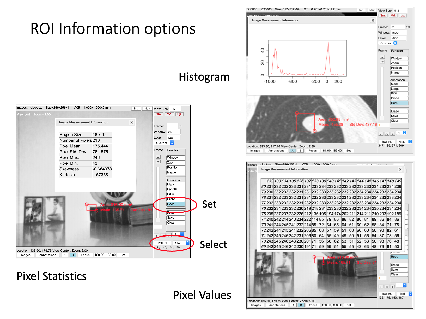 Examples of ROI Review